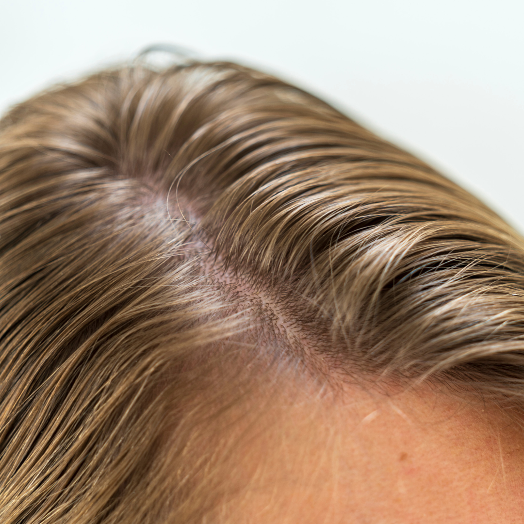 Warum sind unsere Haare im Sommer fettiger? –MakeMyMask